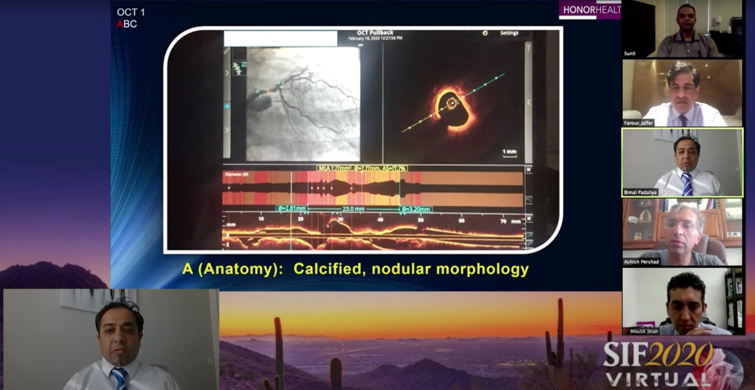 Interactive Case Reviews - SIF 2025
